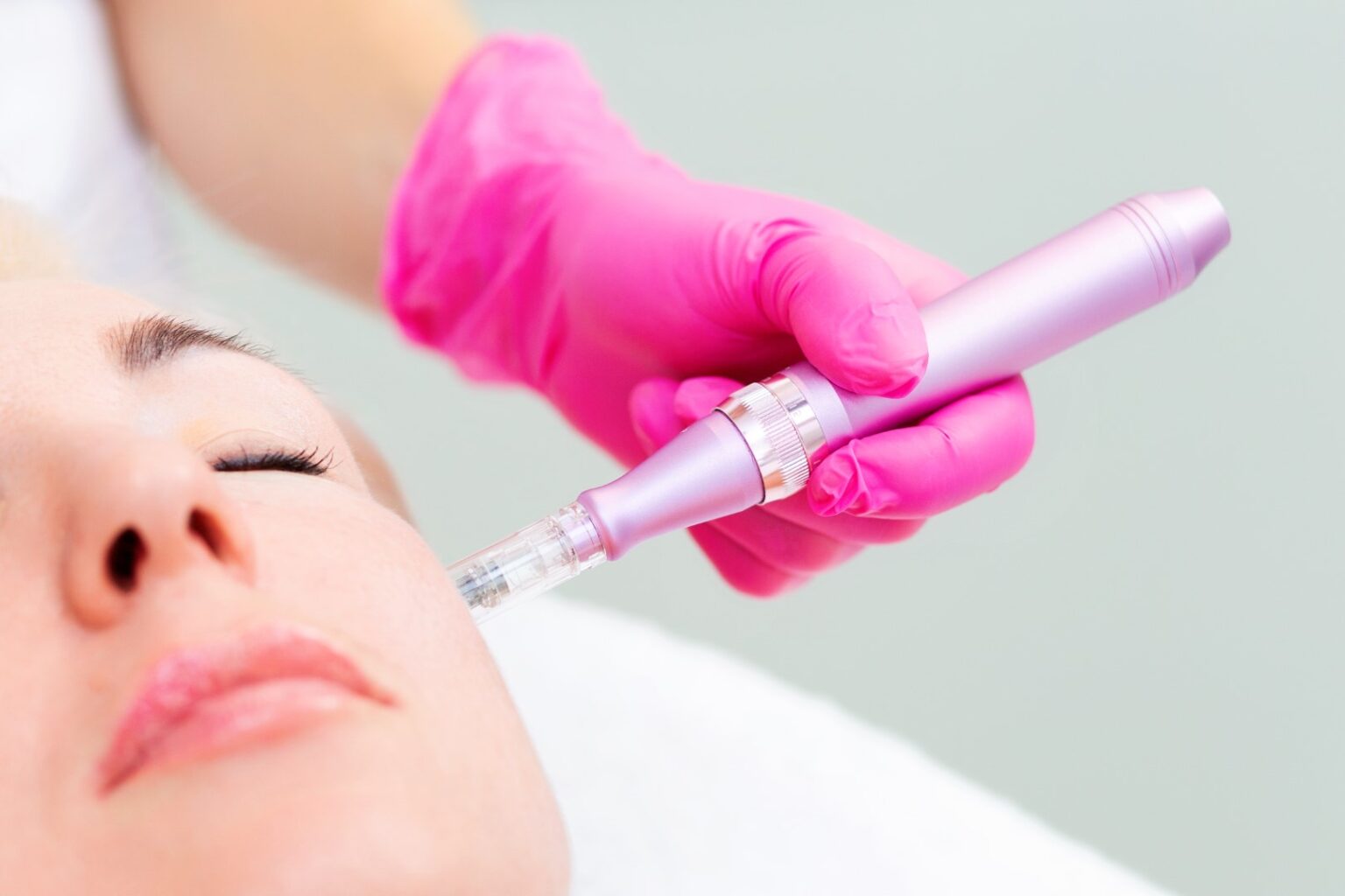 Microneedling / CIT - Michael Ducato. M.D., P.C.